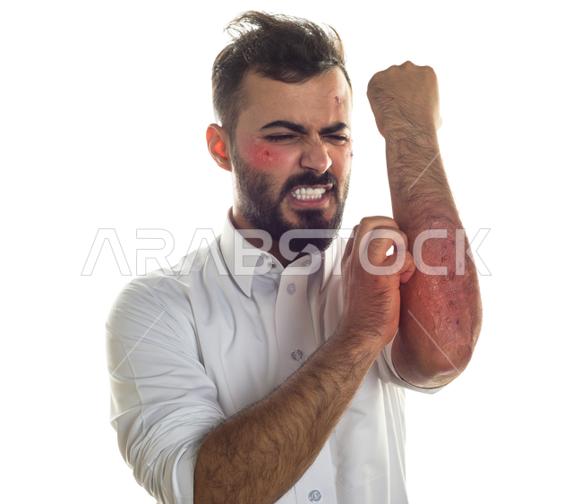 Portrait of a Saudi Gulf man with several problems in the face area ...