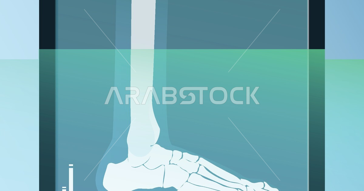 Vector X-ray, human body scan, imaging of leg joints, skeleton, vector ...