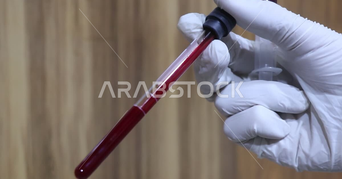 Slow motion of a doctor moving a blood sample, laboratory samples ...