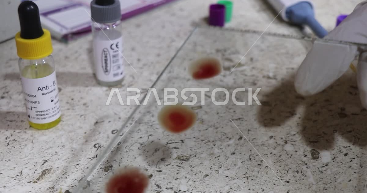 Close-up of a laboratory doctor holding a glass plate, examination of ...