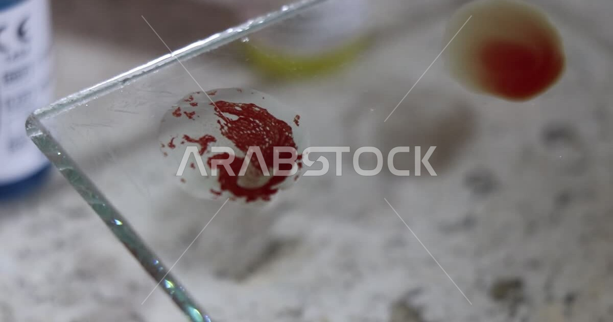 Close-up of blood samples on a glass plate, examination of blood ...