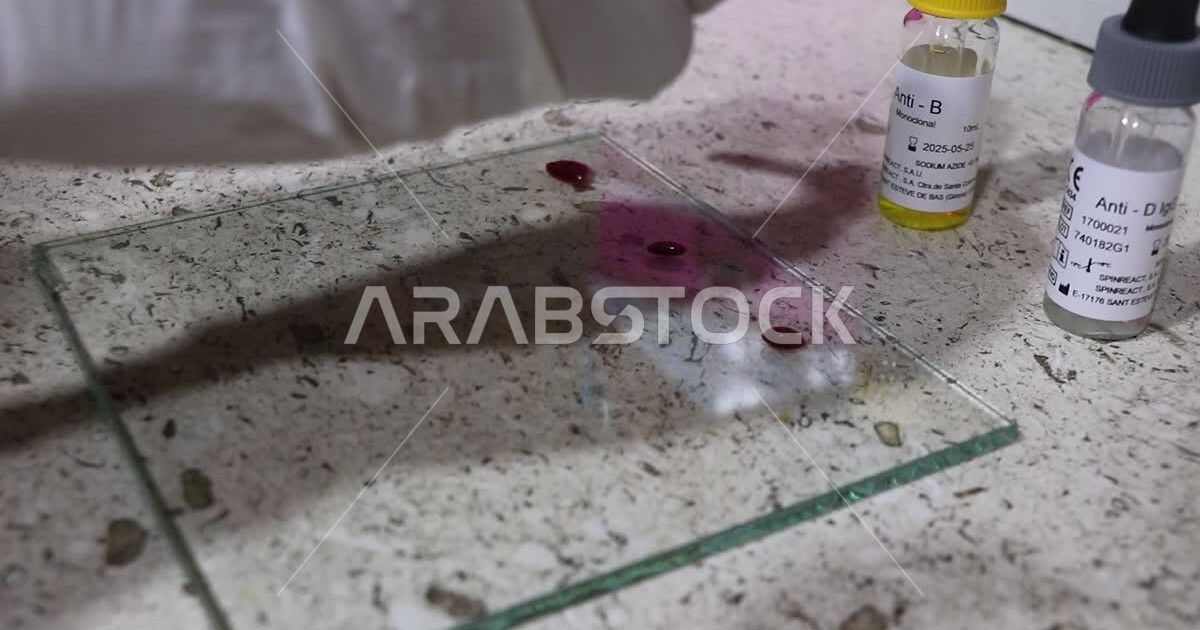 Close-up of a laboratory doctor examining blood samples, glass plate ...