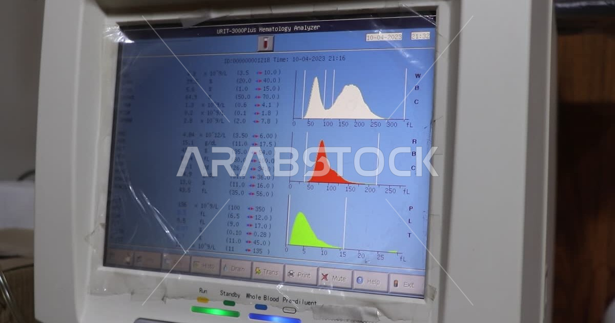 Close-up of a blood test screen, medical devices, laboratory samples ...