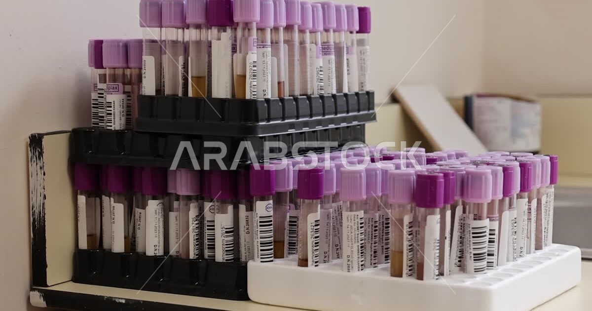 A set of laboratory sample tubes, blood analysis ampoules in medical ...
