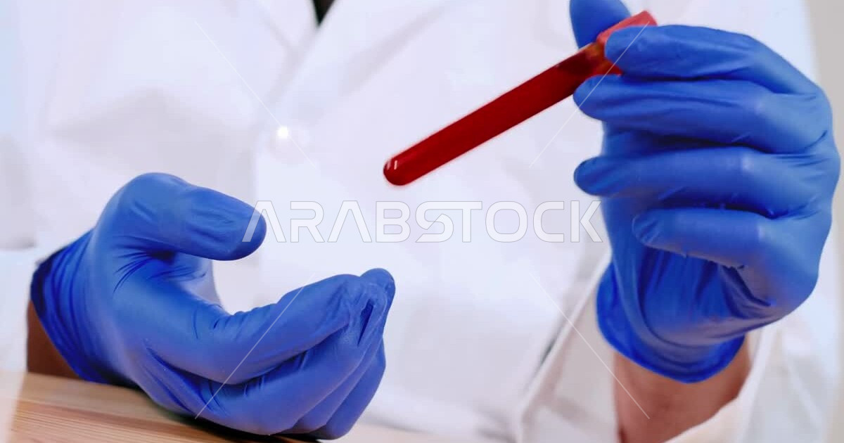 A blood sample tube for someone infected with the Coronavirus, a close ...